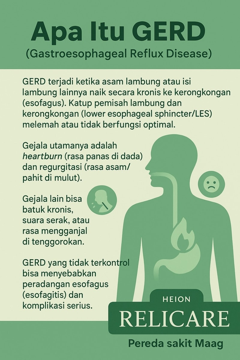 Cara Cepat Meredakan Gejala Maag & GERD Secara Alami